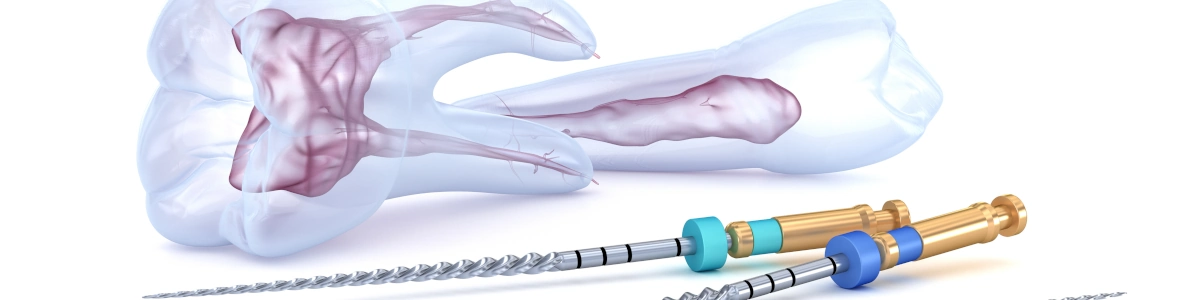 Diagnose endodontischer Erkrankungen | DocMedicus Zahnlexikon