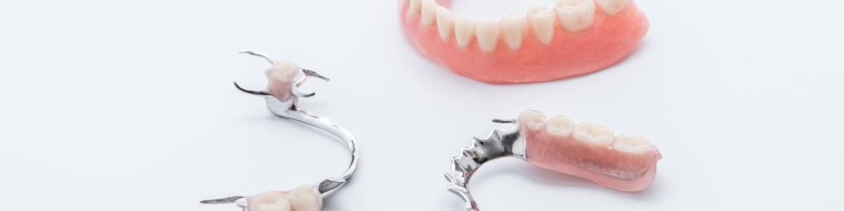 Totalprothese (Vollprothese) | DocMedicus Zahnlexikon