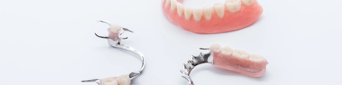 Modellgussprothese | DocMedicus Zahnlexikon